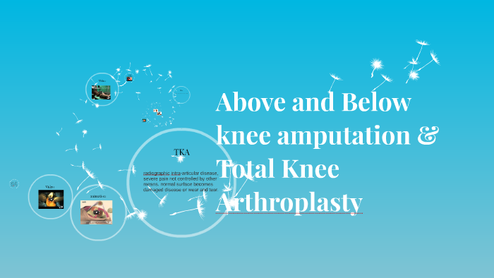 Above and Below knee amputation & Total Knee Arthroplasty by maggie ball