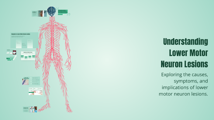 Understanding Lower Motor Neuron Lesions by Anas jjj on Prezi