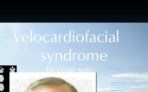 velocardiofacial syndrome by cesar soto on Prezi