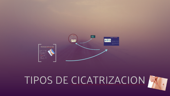 CICATRIZACION by Andi Teran on Prezi