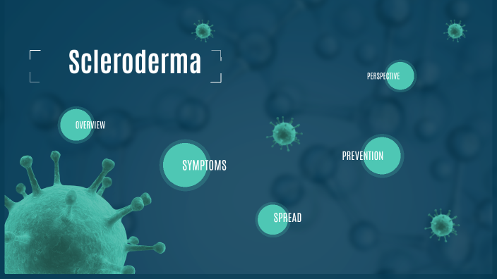 Sclerderma by Diana Ortiz Cerno on Prezi