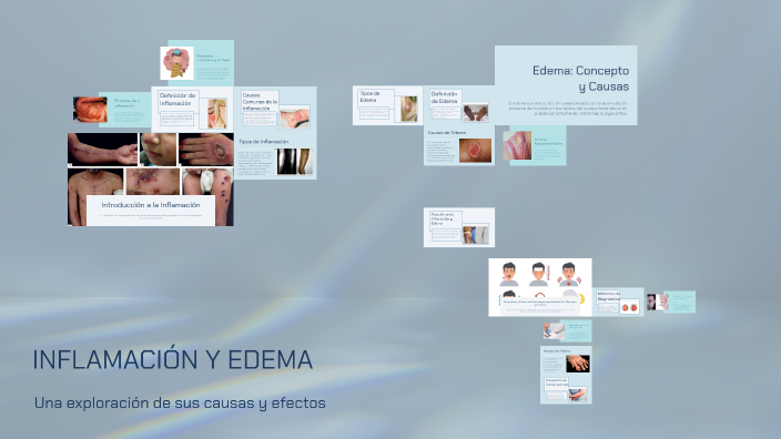 INFLAMACIÓN Y EDEMA by Martin Sánchez on Prezi