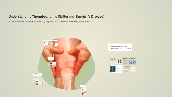 Understanding Thromboangiitis Obliterans (Buerger’s Disease) by ...