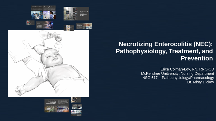 Necrotizing Enterocolitis (NEC): Pathophysiology, Treatment, and ...