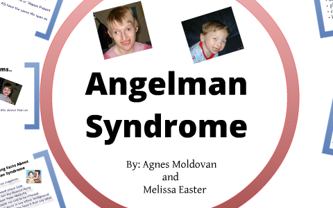 Angelman Syndrome by agnes moldovan on Prezi