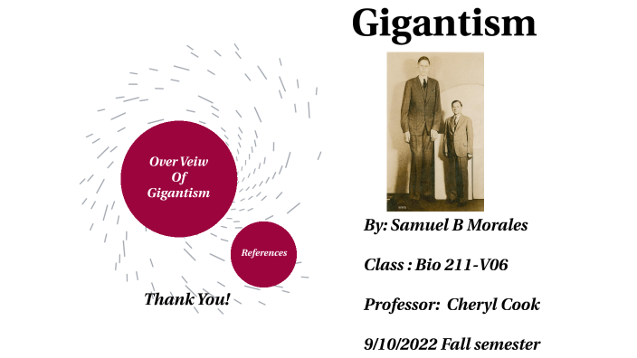 Gigantism Presentation by Samuel Morales on Prezi