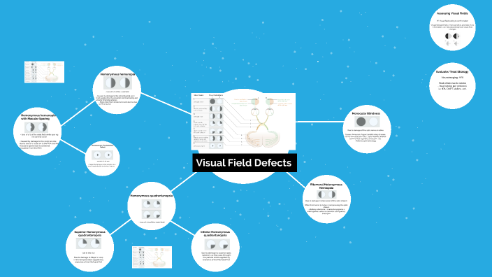Visual Fields Defects by Jacqueline Townshend on Prezi