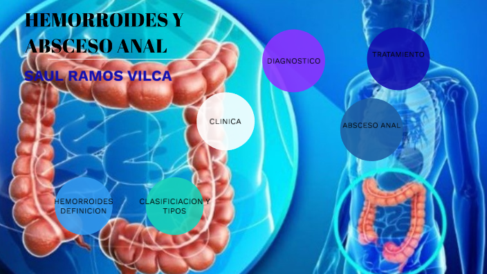 hemorroides y absceso anal by saul ramos vilca on Prezi