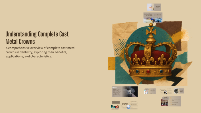 Understanding Complete Cast Metal Crowns by Fedaa Ahmad on Prezi