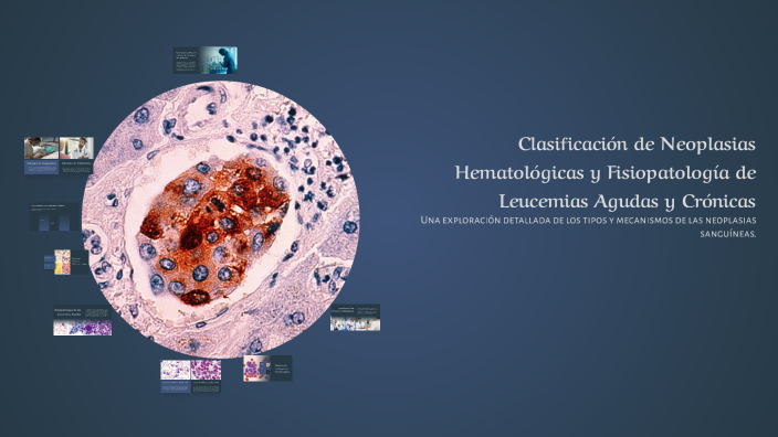 Clasificación de Neoplasias Hematológicas y Fisiopatología de Leucemias ...