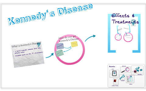 Kennedy's Disease by zachary Dickerson on Prezi