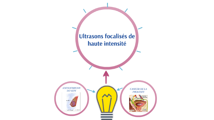 ADENOFIBROME DU SEIN by NoJeaCa BAMARI on Prezi