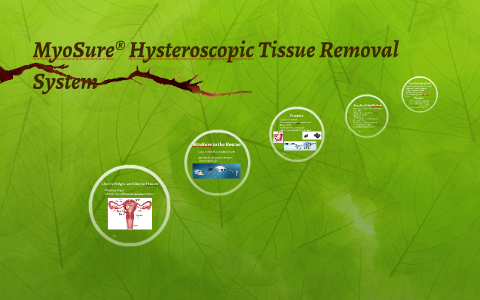 MyoSure® Hysteroscopic Tissue Removal System by Andrew Smith on Prezi