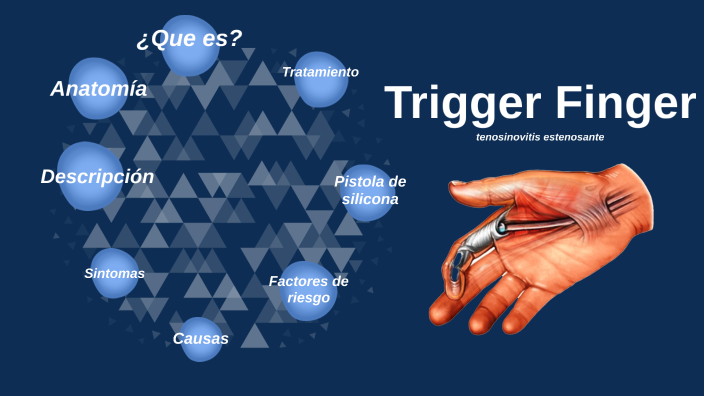Trigger finger by Agustin Varela on Prezi