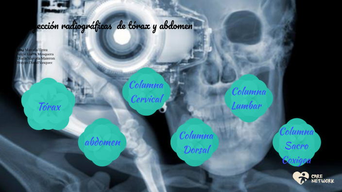 Estudios radiograficos de torax y abdomen by lina marcela urrea perilla ...