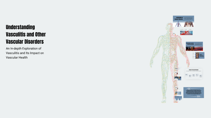 Understanding Vasculitis and Other Vascular Disorders by Reiko - ريكو ...
