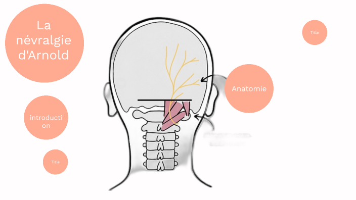 Nevralgie Darnold Reconnue Mdph