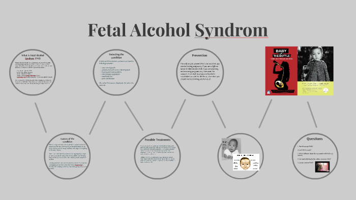 Fetal Alcohol Syndrom by Emilia Oliveira on Prezi