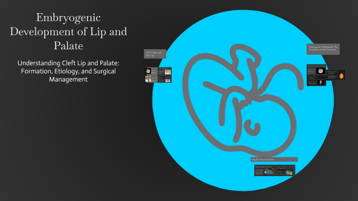 Embryogenic Development of Lip and Palate by Sama Mohamed on Prezi