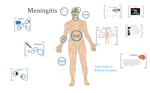 Nervous System Disorder Project by Brittany Glassberg on Prezi