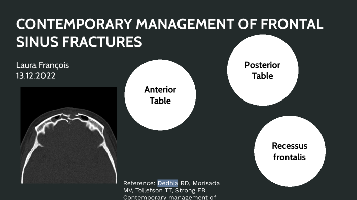 Contemporary Management of Frontal Sinus Fractures by Laura François on ...