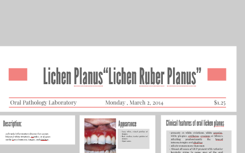 Lichen Planus “Lichen Ruber Planus” by GianCarlo Eduardo on Prezi