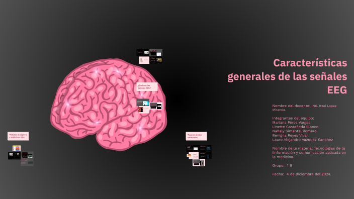 Características generales de las señales EEG by Mariana Pérez Vargas on ...