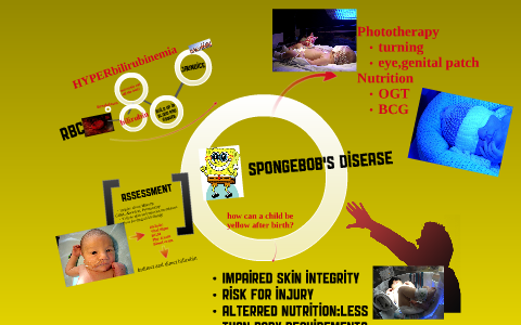 Spongebob's disease by Dexter Ramos on Prezi