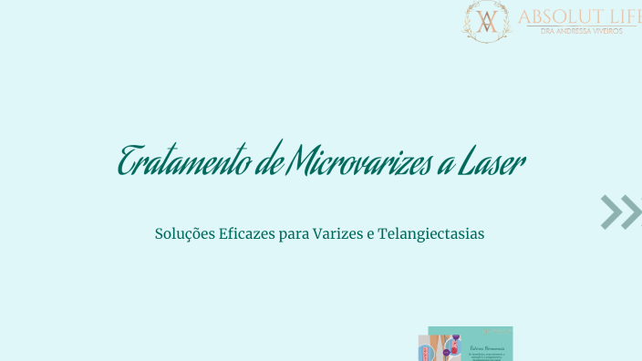 Tratamento de Microvarizes a Laser by Andressa Viveiros de Castro on Prezi