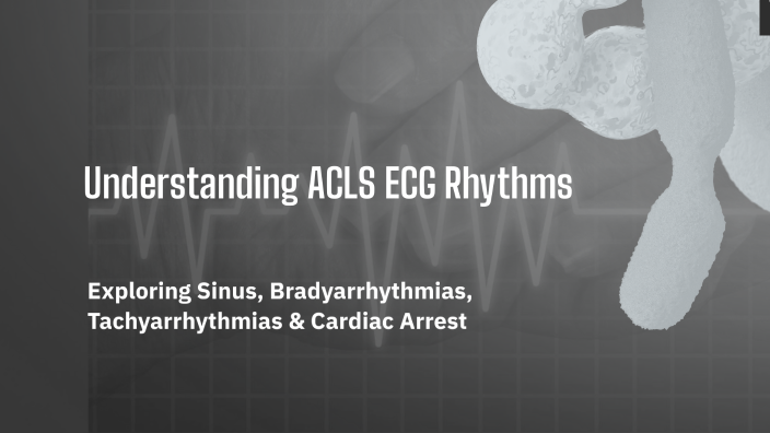 Understanding ACLS ECG Rhythms by charles danie on Prezi