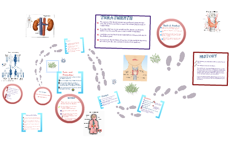 sipple syndrome by anna koeppel on Prezi