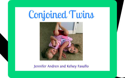 Conjoined Twins by Jennifer Andren on Prezi