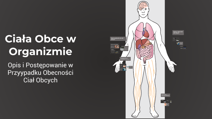 Ciała Obce w Organizmie by Filip Z on Prezi