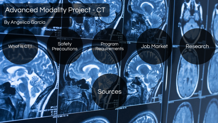 Advanced Modality Project - CT by Angelica Garcia on Prezi
