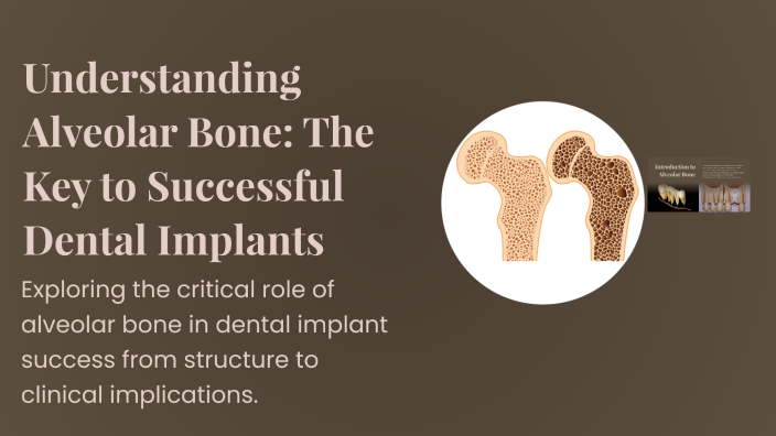 Understanding Alveolar Bone: The Key to Successful Dental Implants by ...