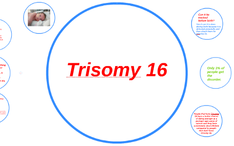 Trisomy 16 by Jon Card on Prezi