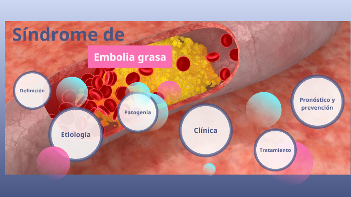 Embolia grasa by Jully Moreira on Prezi