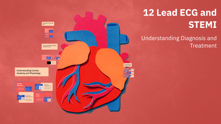 12 Lead ECG and STEMI by Christopher wilson on Prezi