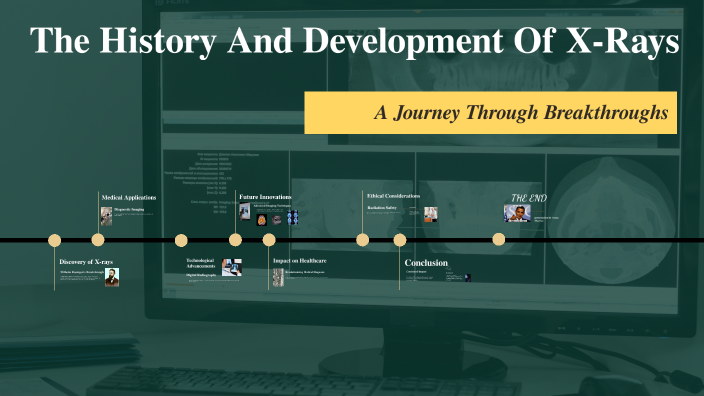 The History And Development Of X-Rays by Azraa Martins on Prezi