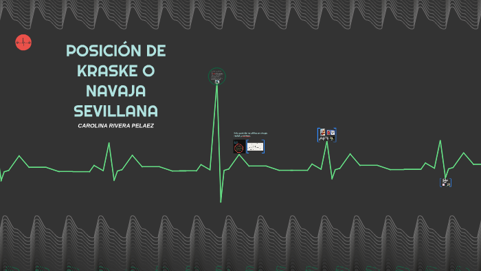 POSICIÓN DE KRASKE by Carolina Rivera on Prezi