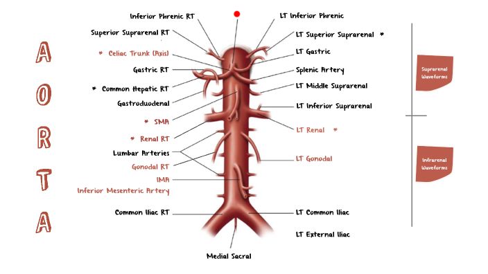 Aorta by Jessica Minier on Prezi