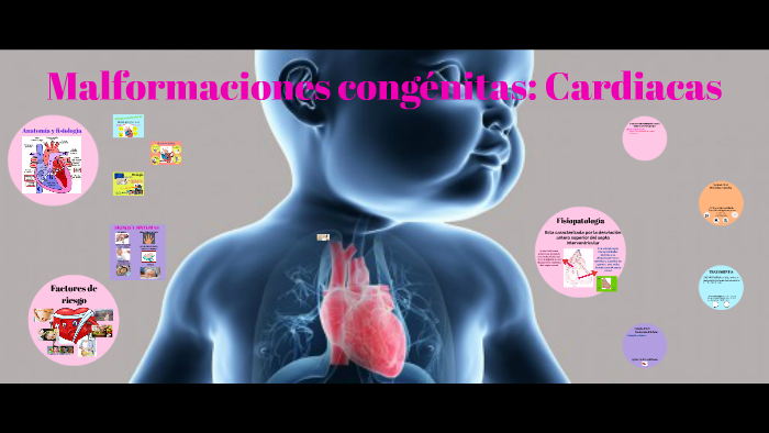 Malformaciones congénitas: Cardiacas by JOSE LUIS PEÑA ROSALES on Prezi