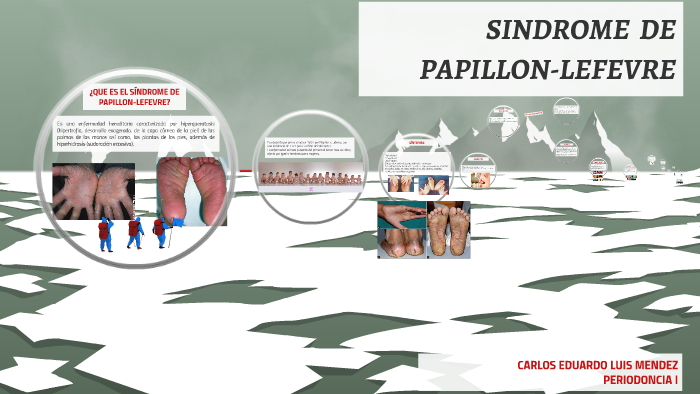 SINDROME DE PAPILLON-LEFEVRE by Charlie Luis Mendez on Prezi