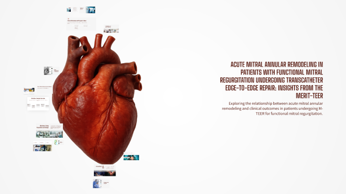ACUTE MITRAL ANNULAR REMODELING IN PATIENTS WITH FUNCTIONAL MITRAL ...