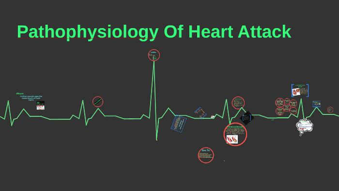 Pathophysiology Of Heart Attack By Gene Naldo