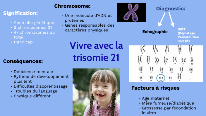 TRISOMIE 21 by rayana zelimchanov on Prezi