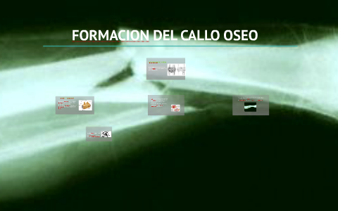 FORMACION DEL CALLO OSEO by wilder Bazan on Prezi