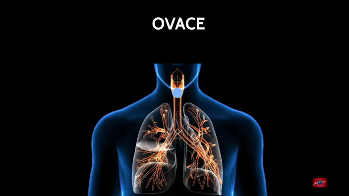 OVACE by Lucas Silva on Prezi