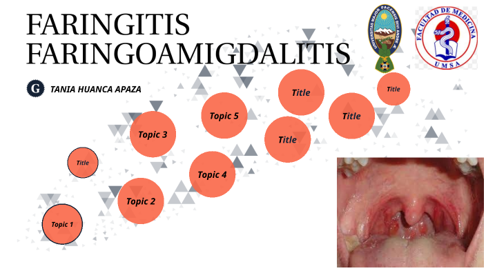 FARINGITIS - FARINGOAMIGDALITIS by tatys mon on Prezi