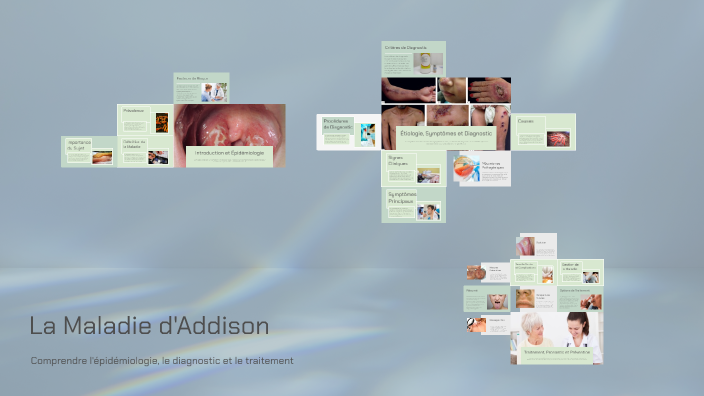 La Maladie d'Addison by Hadjer Louzri on Prezi